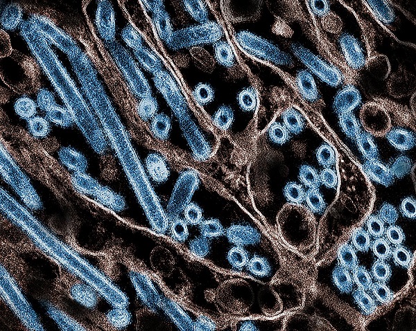 Bovine H5N1 influenza from infected worker transmissible and lethal in ...