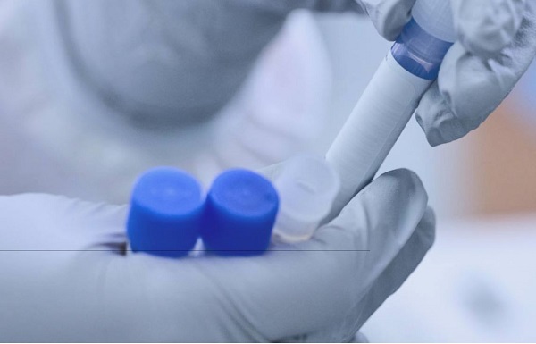 Mayo Clinic Laboratories and Amprion announce collaboration to advance ...